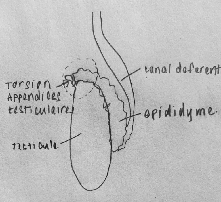 Douleur testiculaire, œdème et tuméfaction - Urgence CHU Sainte-Justine
